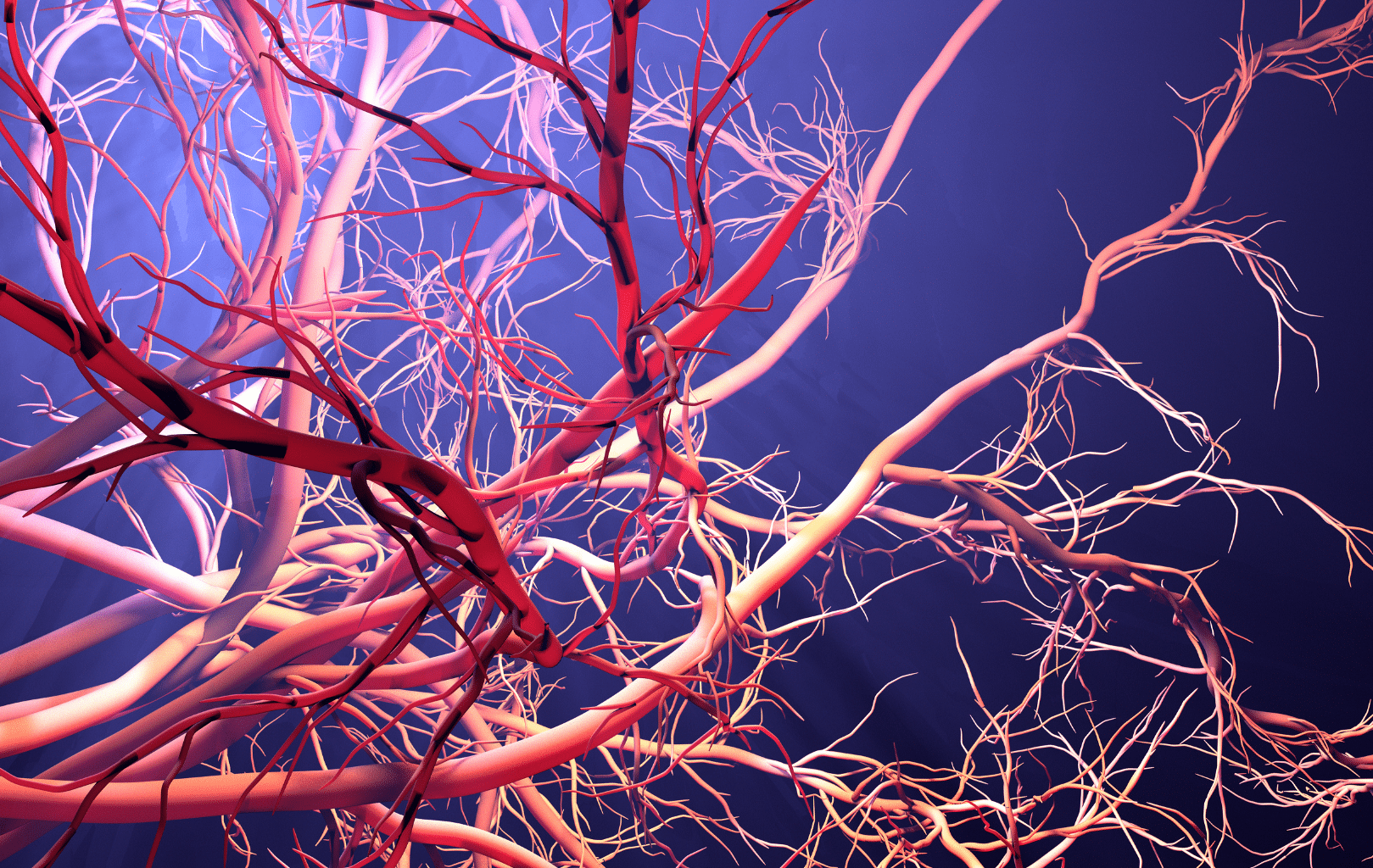 3D-printing the brain’s blood vessels with silicone could improve and ...