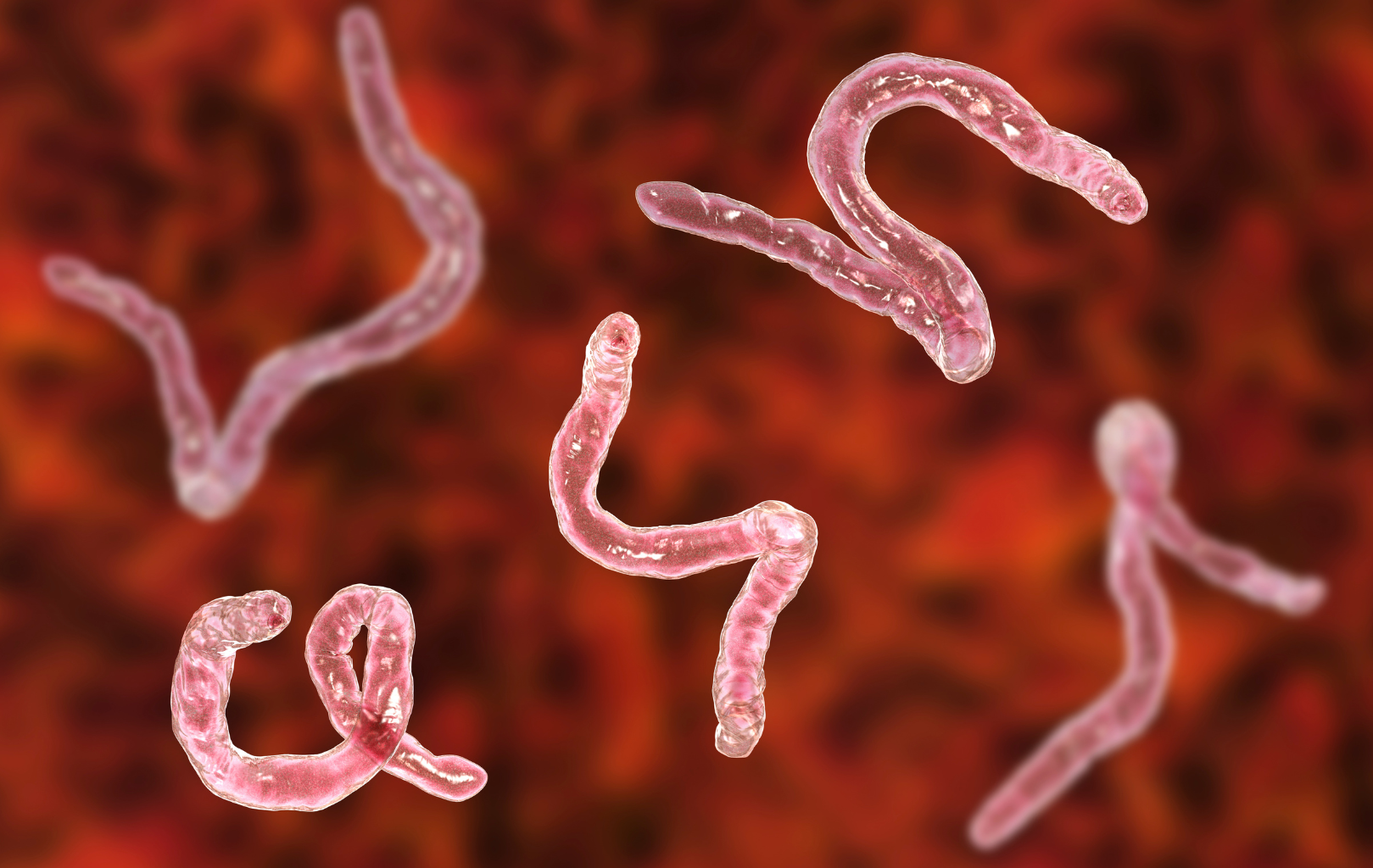 Finding a live brain worm is rare. 4 ways to protect yourself from more ...